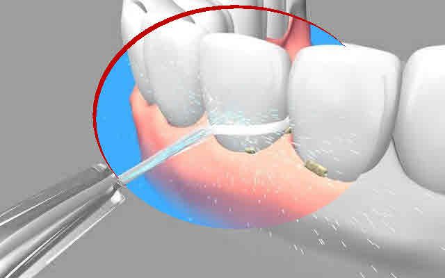 Is Regular Flossing Important to your Oral Health? – Reach Dental
